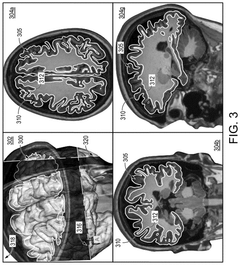 Brain-Computer Interfaces-driven robotic systems for surgical assistance